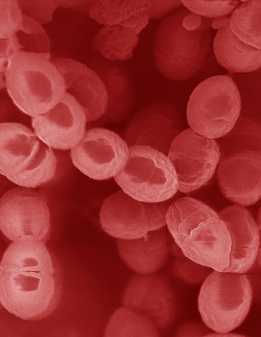 The Therapeutic Potential of Bioengineered Bacteria | clinicallab