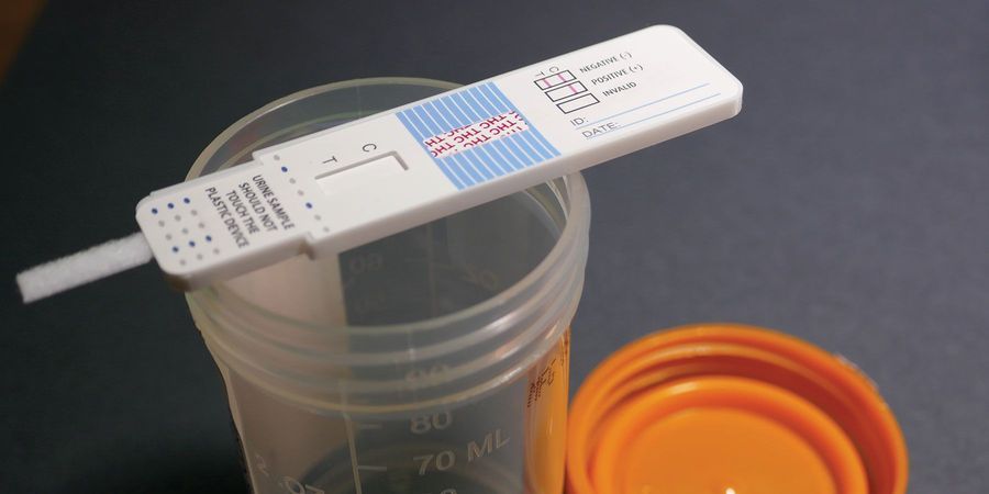 How to Detect Tampered Drug Tests | clinicallab