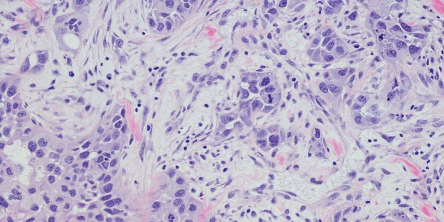 How Whole Slide Imaging is Changing the Role of the Pathologist ...