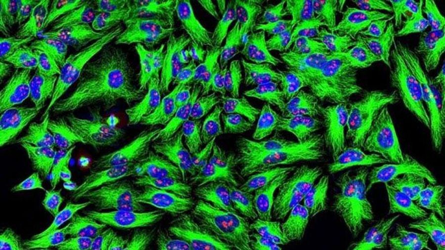 New Cell Lines Produce NIST Monoclonal Antibody for Improved Biologic ...