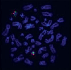 Applications of FISH in Cancer Cytogenetics | clinicallab
