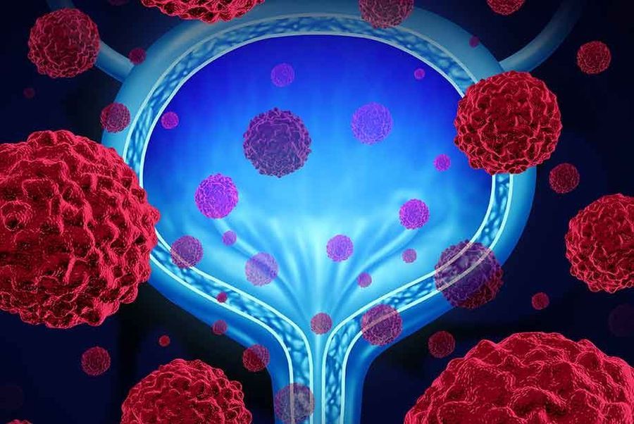 Applications of FISH in Cancer Cytogenetics | clinicallab