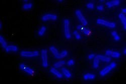 Applications of FISH in Cancer Cytogenetics | clinicallab