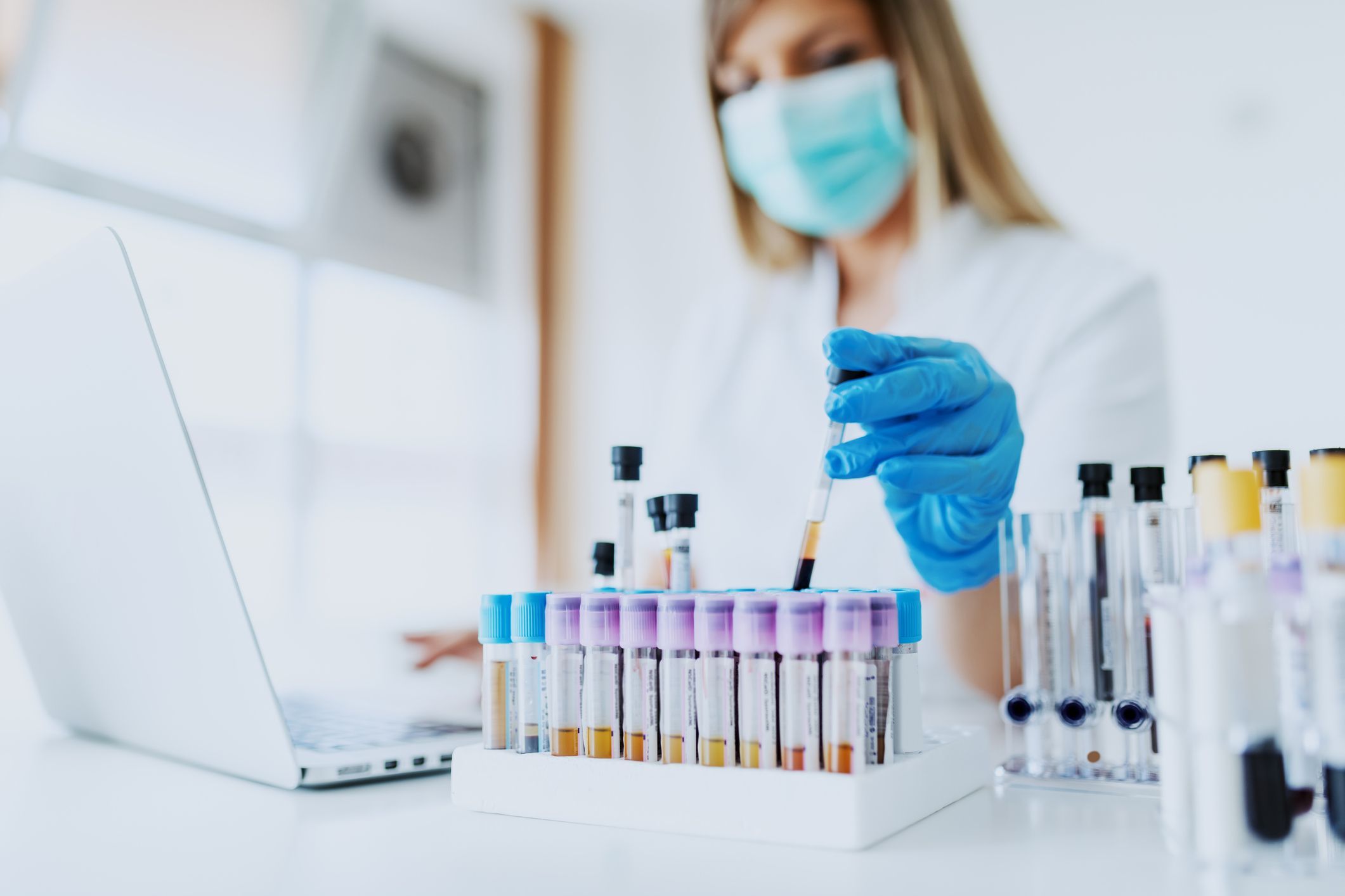 Cancer Testing in Your Lab (Survey) | clinicallab