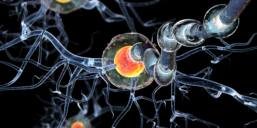 Experts Clarify Subtypes of Multiple Sclerosis | clinicallab