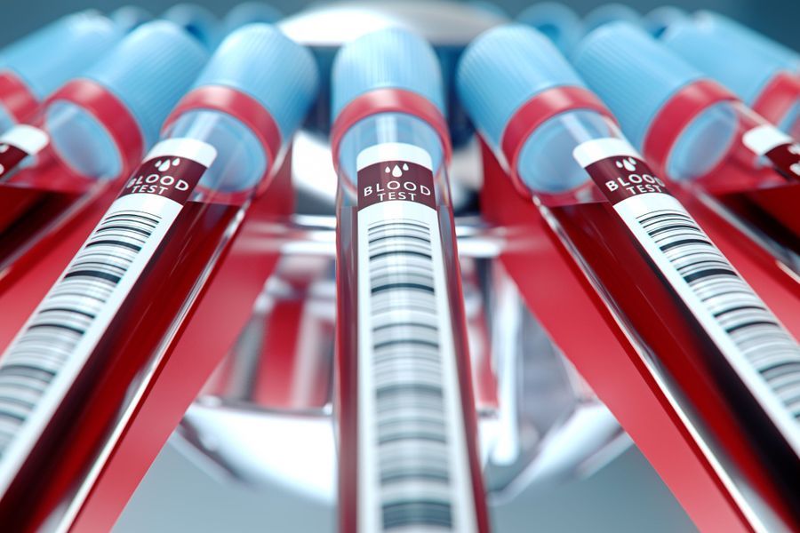 Analytical Challenges in Doping Detection | clinicallab