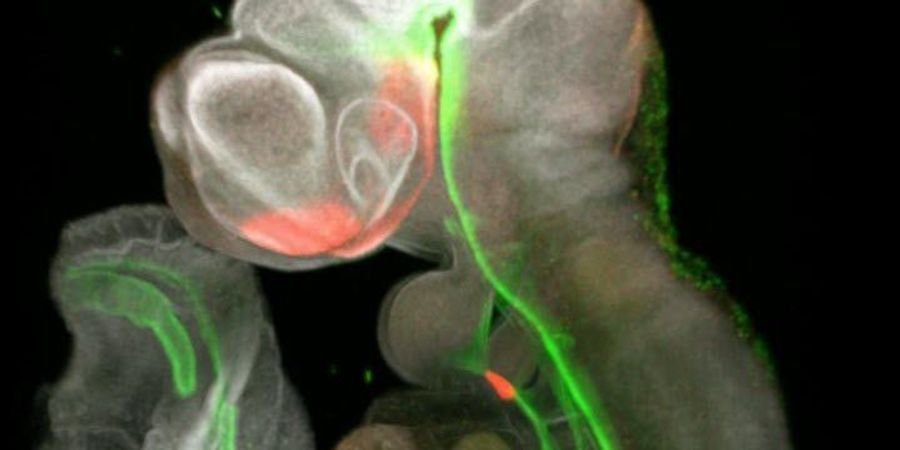 Two Discoveries Boost Next-Generation Organoid Development | clinicallab