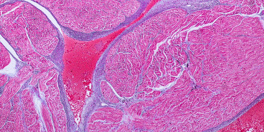 Mapping the Human Heart, Cell by Cell | clinicallab