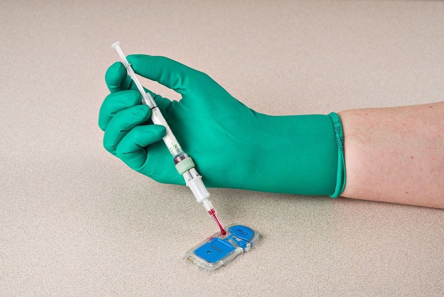 Solutions to Hemolysis in Point-of-Care Testing | clinicallab