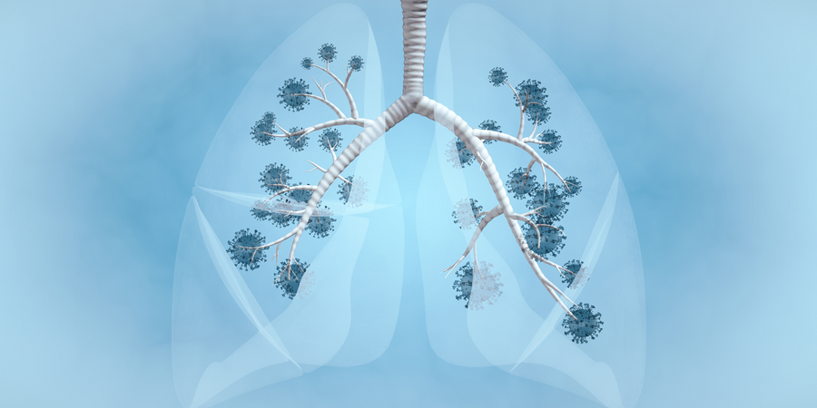 Study Defines Small-Cell Lung Cancer Subtypes and Their Vulnerabilities ...