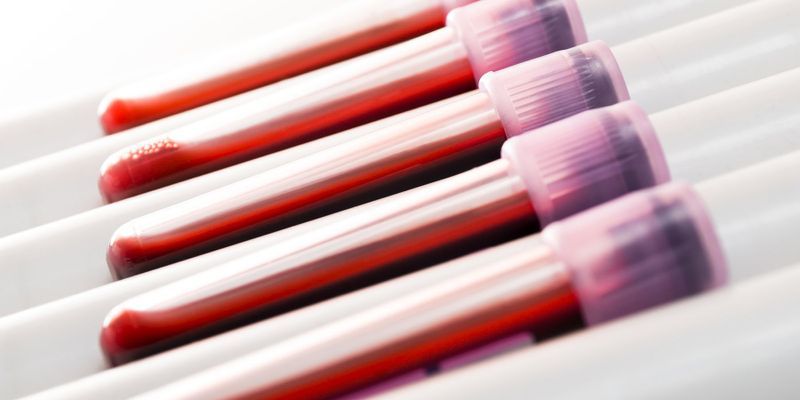 Researchers Identify Blood Markers That Indicate Labor Is Approaching ...