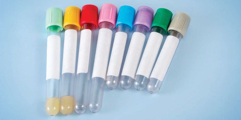 Aligning Laboratory Medicine with Transgender Health Care | clinicallab