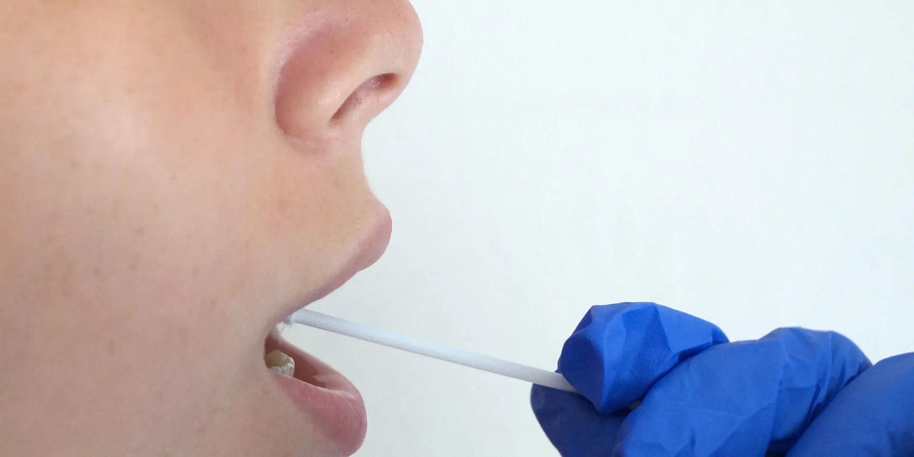 Saliva Testing for COVID-19 Quicker, Safer than Nasal Swabs | Today's ...
