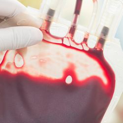 Molecular Testing in the Transfusion Medicine Laboratory | clinicallab
