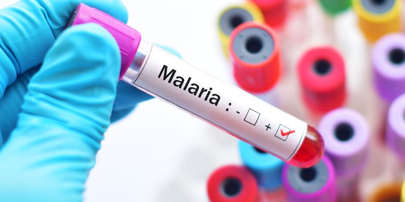 Digital PCR Method Could Help with Selecting Rapid Malaria Tests ...