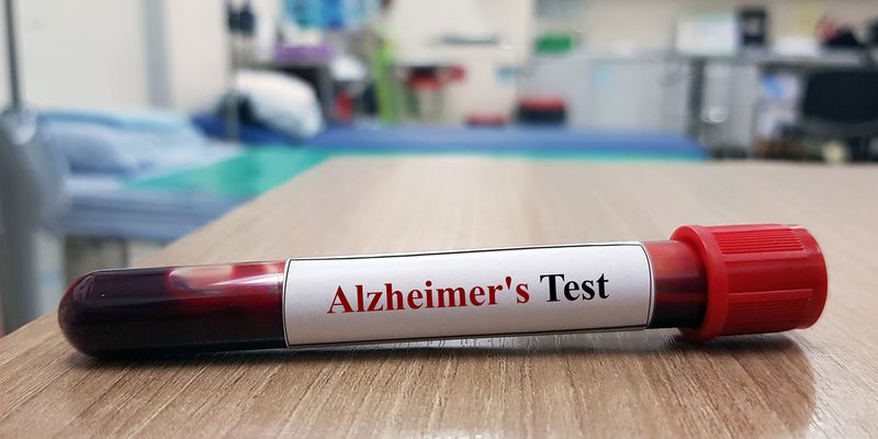 Blood Test Can Detect ‘Toxic’ Protein Years before Alzheimer’s Symptoms ...