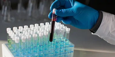 AMP Releases Liquid Biopsy Assay Validation Recommendations | Today's ...