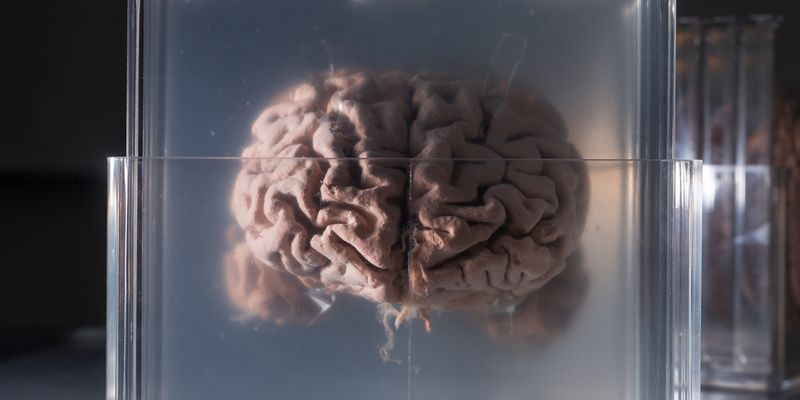 World’s First Brain Biobank Accelerates Clinical Research | clinicallab