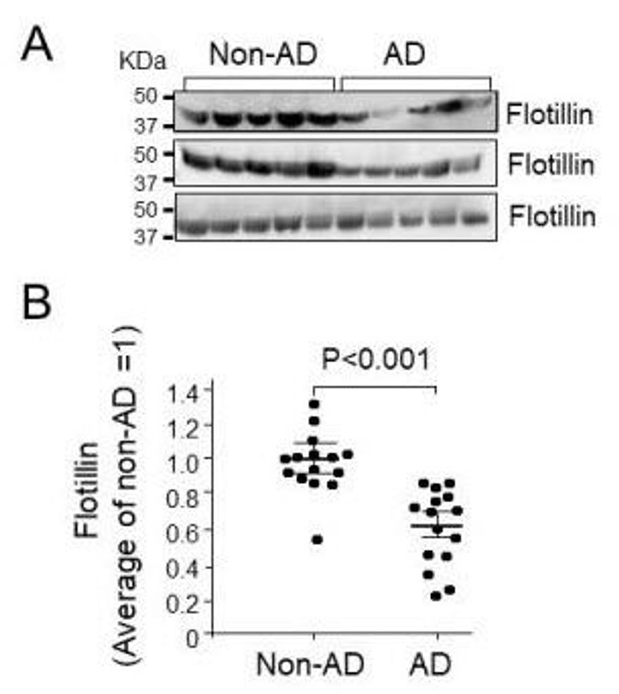 Flotillin Is a Novel Diagnostic Blood Marker of Alzheimer's Disease ...