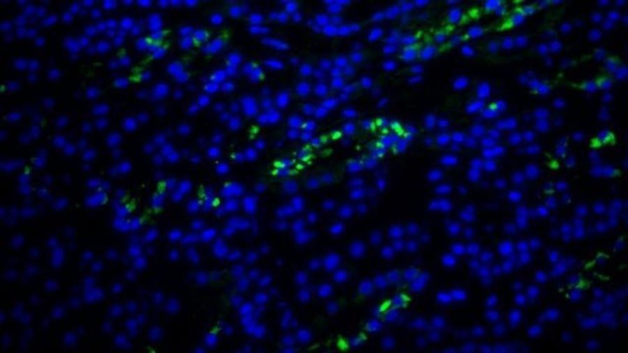 Viruses Under the Microscope | Today's Clinical Lab