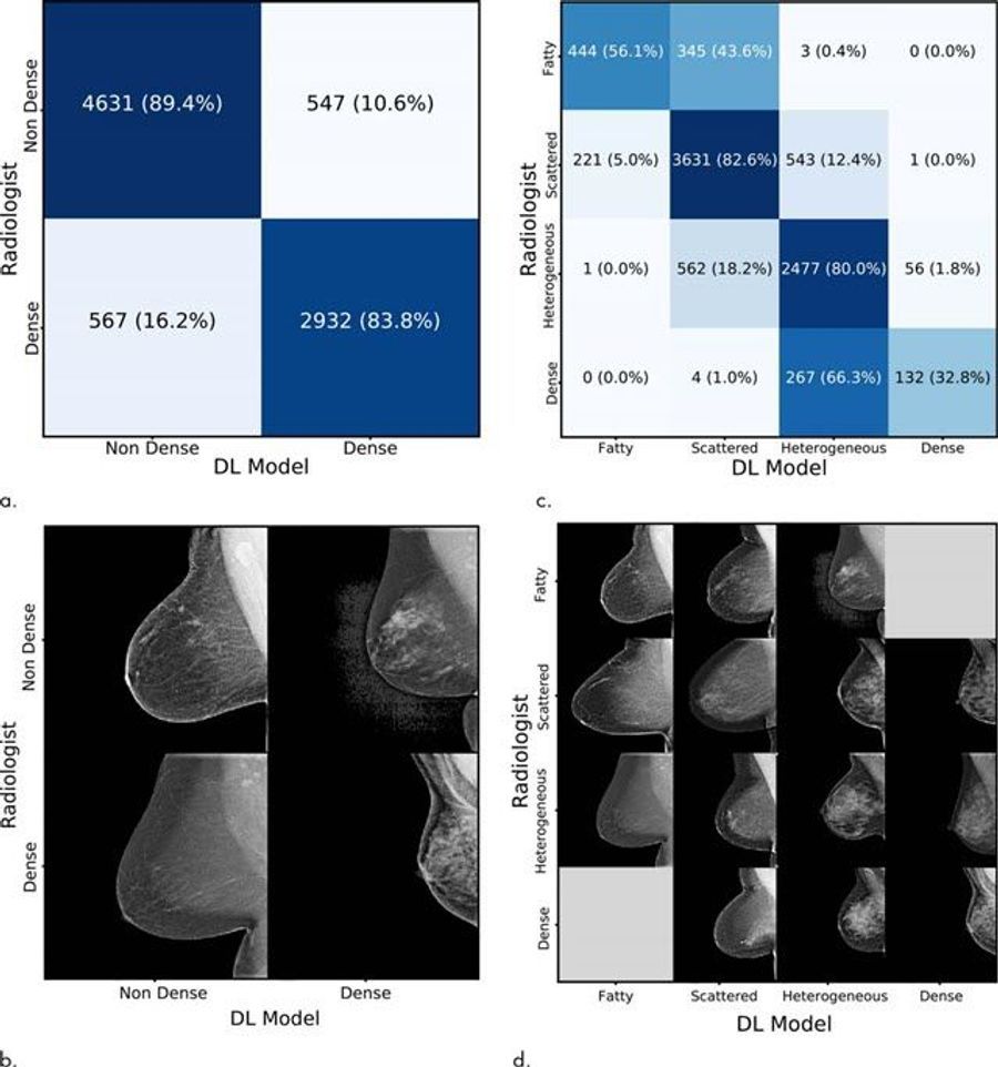 Artificial Intelligence Used in Clinical Practice to Measure Breast ...