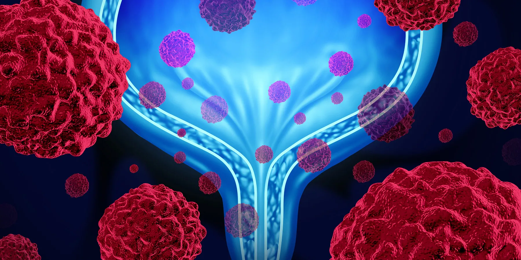 Pembrolizumab Shows Positive Results in Bladder Cancer Trial | clinicallab