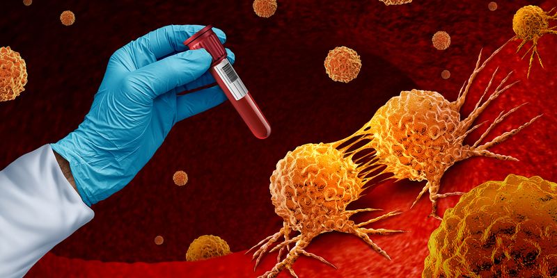 NIH’s Network to Assess New Cancer Detection Tests and Tech | clinicallab