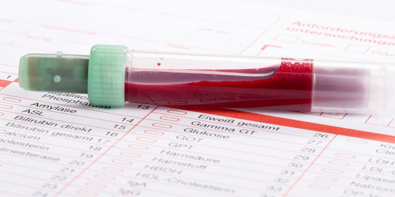 Blood Biomarkers in Patients with Arthritis Predict CVD Risk | Today's ...