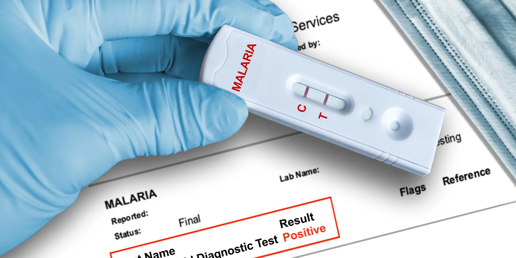 New Rapid Point-of-Care Malaria Test Is Robust and Accurate | clinicallab