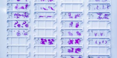 Cell & Tissue Culture Articles | clinicallab