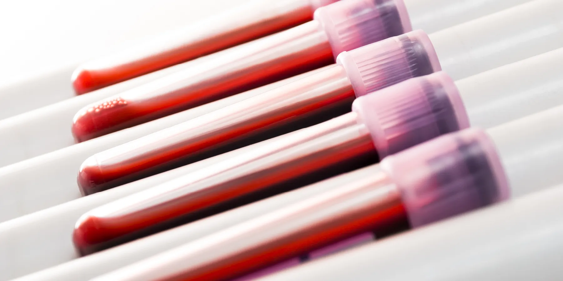 New Collection Tubes Preserve and Stabilize Blood Proteins | Today's ...