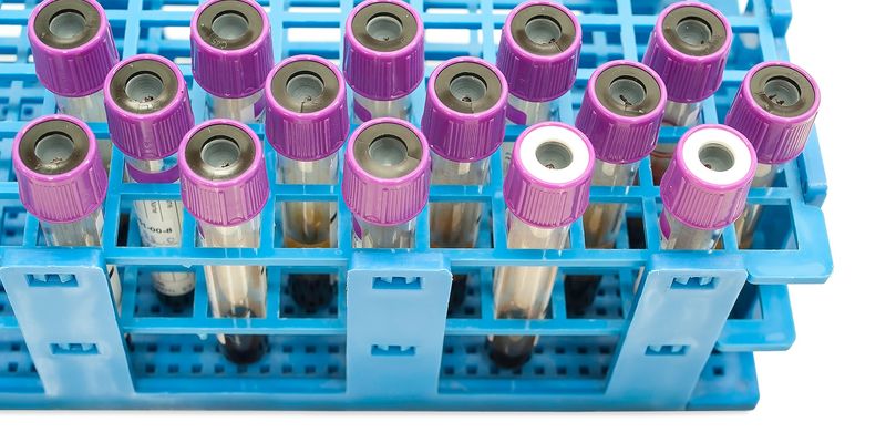 Transforming Early Cancer Detection with Liquid Biopsy, Automation, and ...