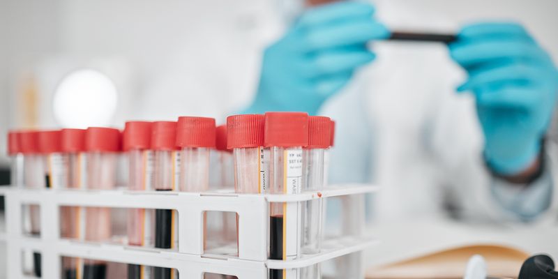 Improve Diagnostic Reliability and Efficiency With a Novel LC-MS Panel | Today's Clinical Lab