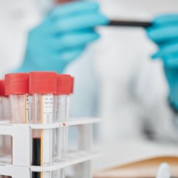 Enhance Your Lab’s Blood Smear Analysis with Digital Microscopy ...