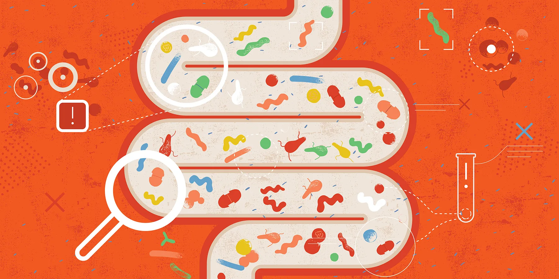 Diagnostic Stewardship Approach To C Diff Reduces Unnecessary Testing Clinicallab