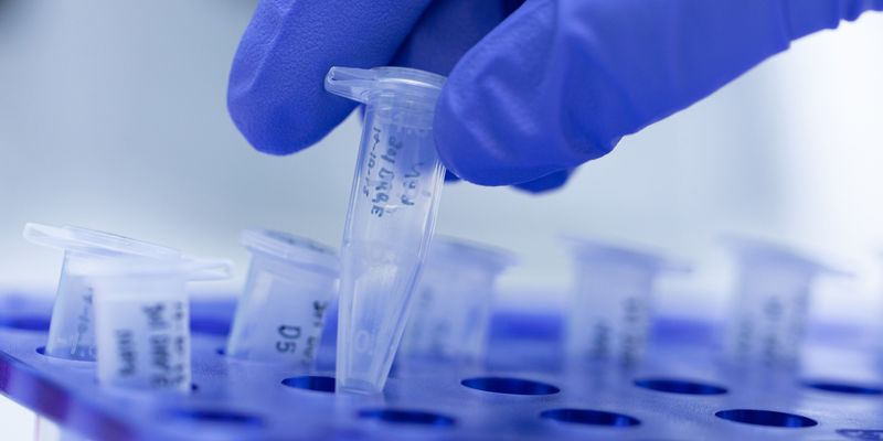 Streamline Your PCR Workflow with Lyophilized Master Mix Solutions ...