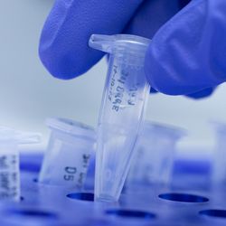 The Bead You Need: How Lyophilization is Changing Point-of-Care Diagnostics | clinicallab