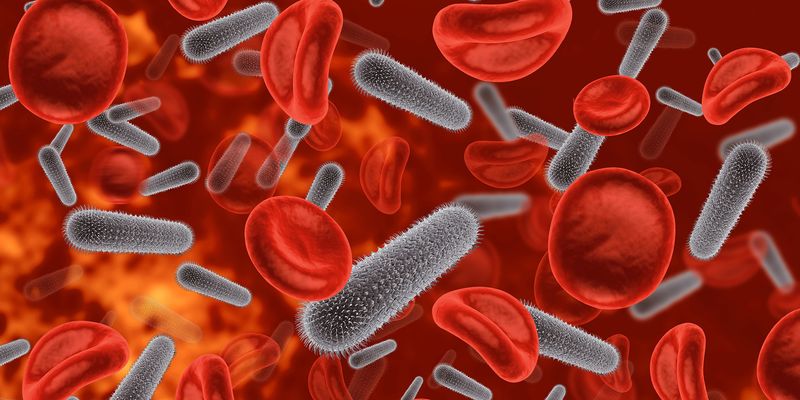 Breakthrough Sepsis Test Could Save Lives and Billions by Catching the ...