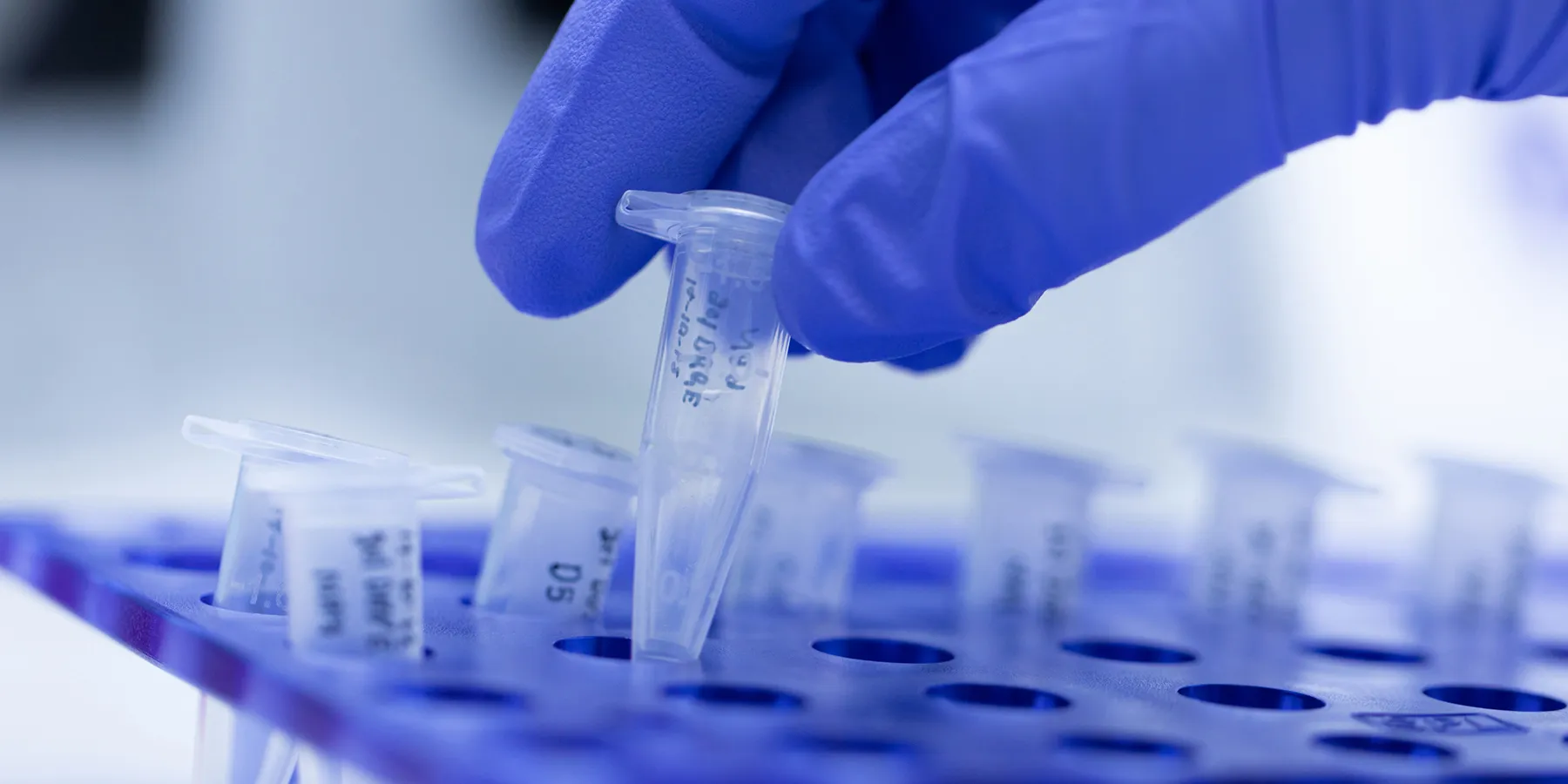 Experts Recommend Testing Children for Underdiagnosed Genetic Heart ...