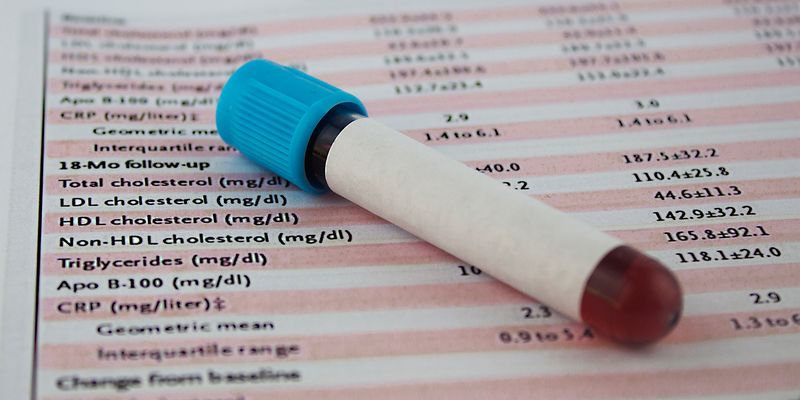 ADLM Releases New Guidance on Coagulation Testing to Improve Care for ...