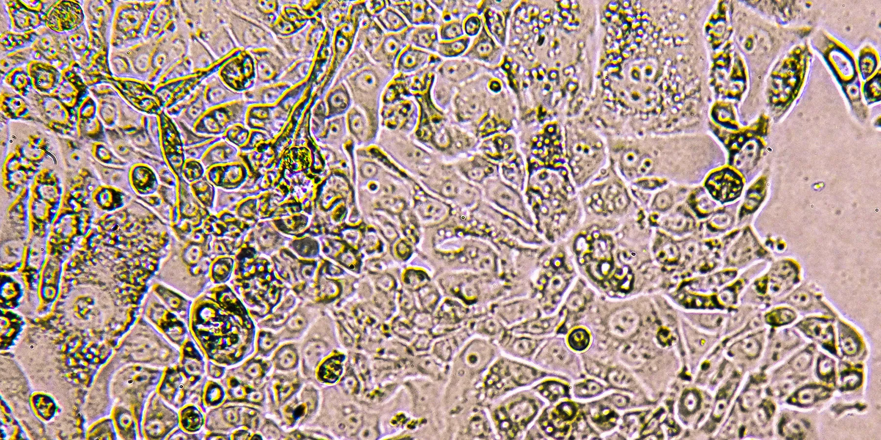 OHSU Researchers Identify New Tools for Early Cancer Detection ...