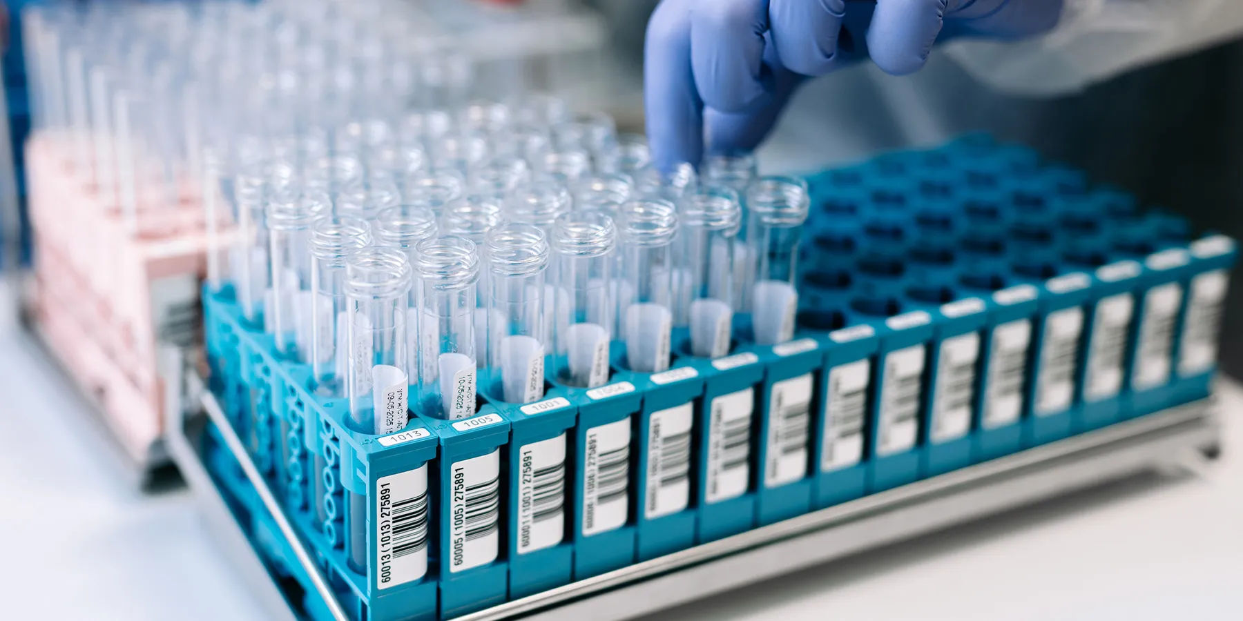 Why STI Testing Still Isn’t Decentralized—Rethinking STI Diagnostics ...